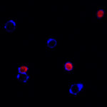 Calcofluor White Stain, 5 mM in water - Biotium