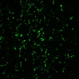 Tyramide Amplification Buffer Plus - Biotium