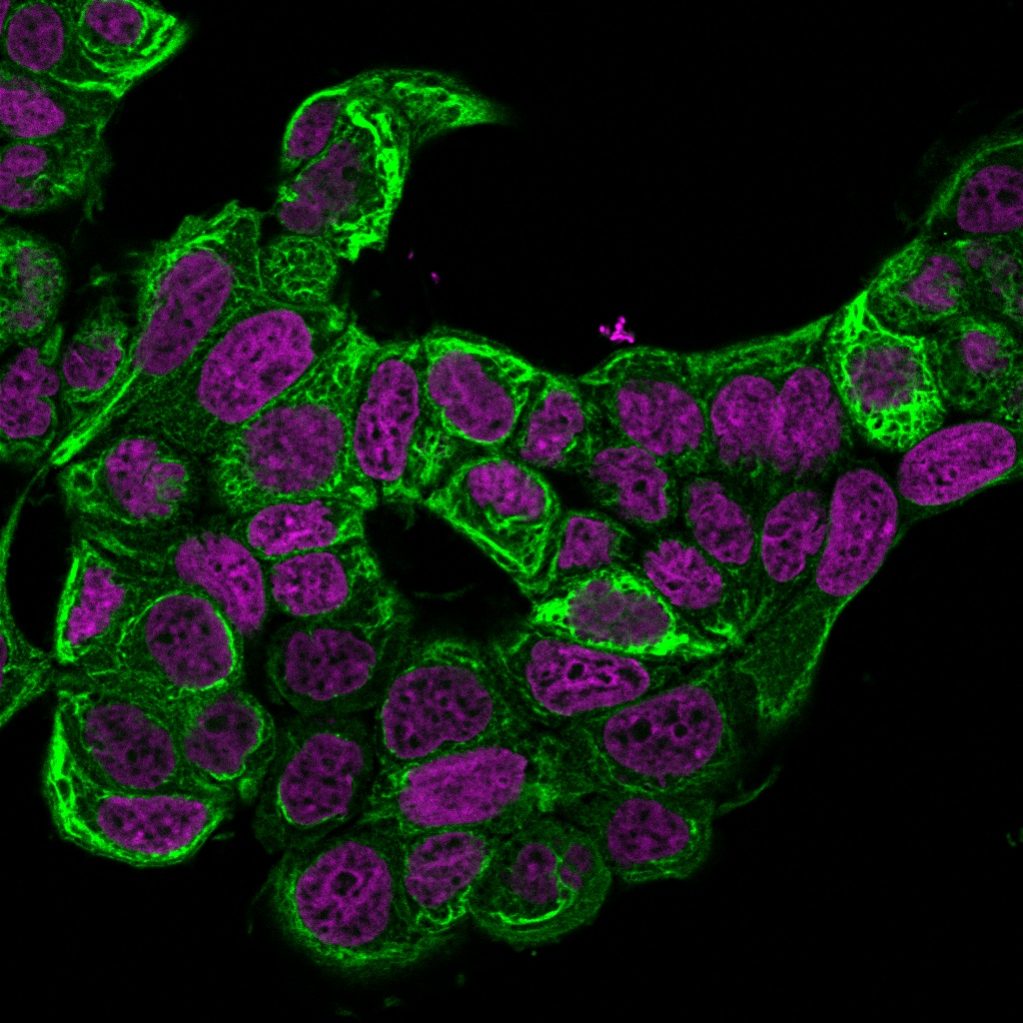 Cytokeratin 18 Monoclonal Mouse Antibody (KRT18/834) - Biotium