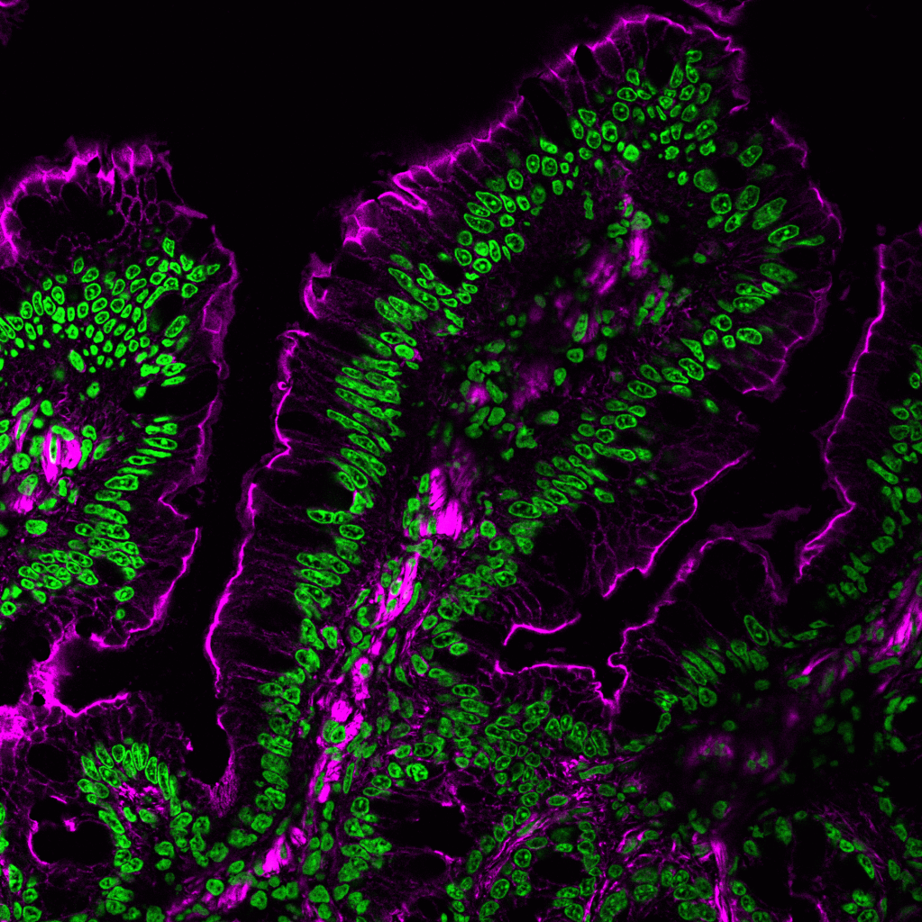 Phalloidin Conjugates - Biotium