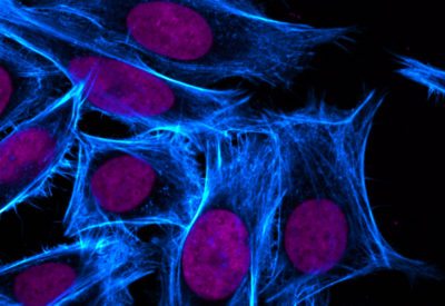 Phalloidin Conjugates | Biotium