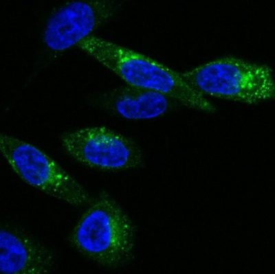 Fluorescent Cell Stains for Organelles & Cellular Structures | Biotium