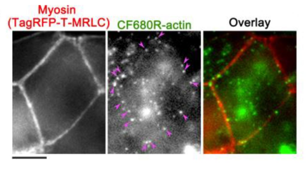 An infrared actin probe for single-molecule speckle (SiMS) microscopy ...