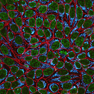Membrane & Cell Surface Stains Comparison - Biotium