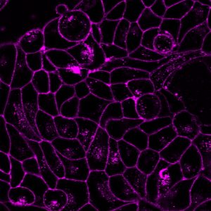 Membrane & Cell Surface Stains Comparison - Biotium