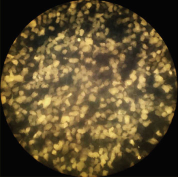 Fluoro-Gold™-Labeled Retinal Explant Culture for Neurotoxicity ...