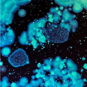 Total and viable bacteria and fungi in the International Space Station ...