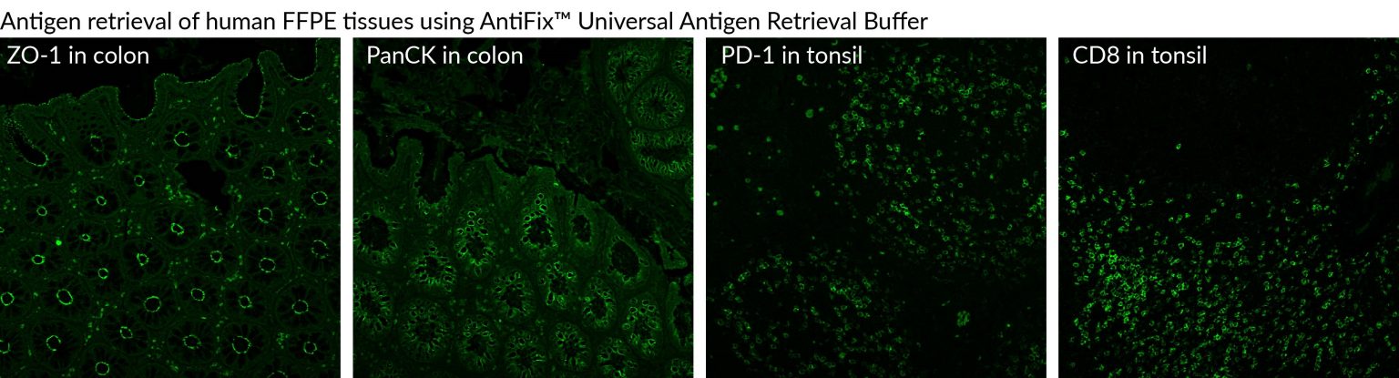 AntiFix™ Universal Antigen Retrieval Buffer, 10X - Biotium