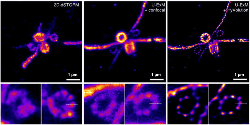 Blowing Up the Microscopic with Expansion Microscopy - Biotium
