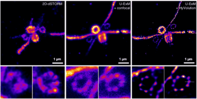 Blowing Up the Microscopic with Expansion Microscopy - Biotium