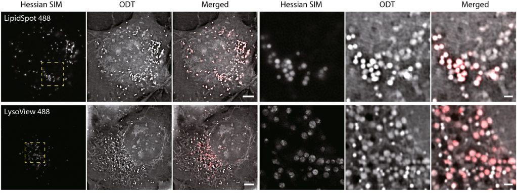 Super-Resolution Microscopy - Biotium