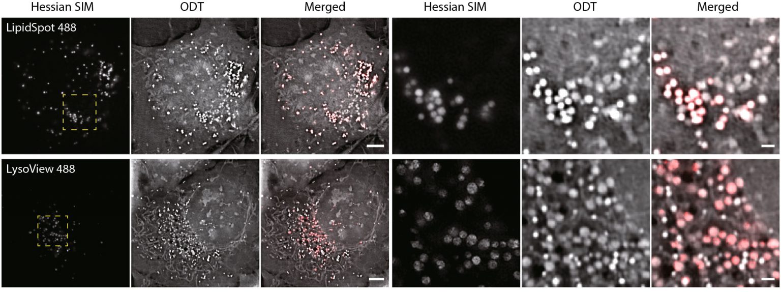 Super-Resolution Microscopy - Biotium
