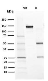 Cytochrome P450 1A1/1A2 Monoclonal Mouse Antibody (MC1) - Biotium