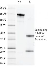 Mucin 1 / EMA / Episialin / CD227 Monoclonal Mouse Antibody (VU-11D1 ...
