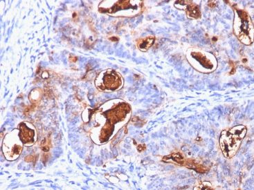 CD66 / CEA Monoclonal Mouse Antibody (C66/1260) - Biotium
