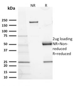 CD117 / c-Kit Monoclonal Mouse Antibody (KIT/2673) - Biotium