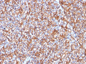 Spectrin Beta III Monoclonal Mouse Antibody (SPTBN2/1778) - Biotium