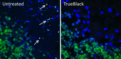 TrueBlack® Lipofuscin Autofluorescence Quencher is the preferred ...