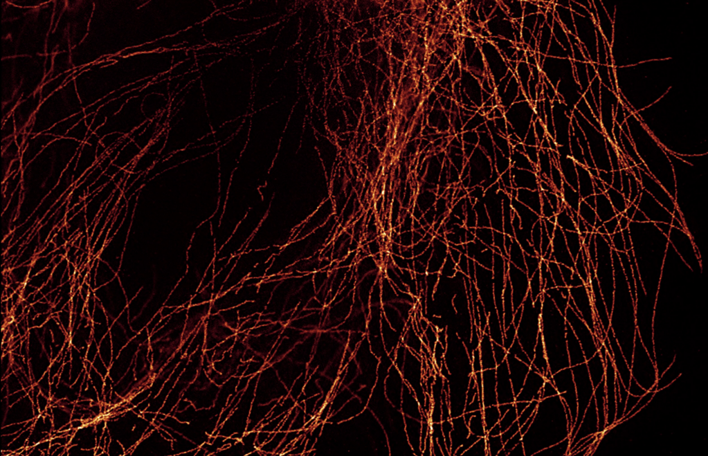 The molecular architecture of the photoreceptor active zone resolved ...