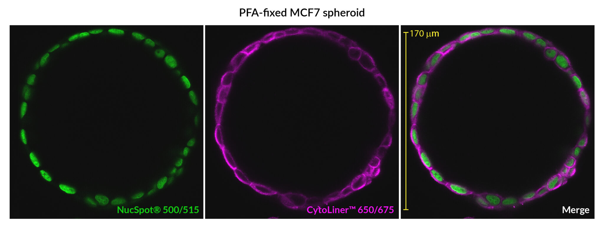CytoLiner™ Fixed Cell Membrane Stains - Biotium