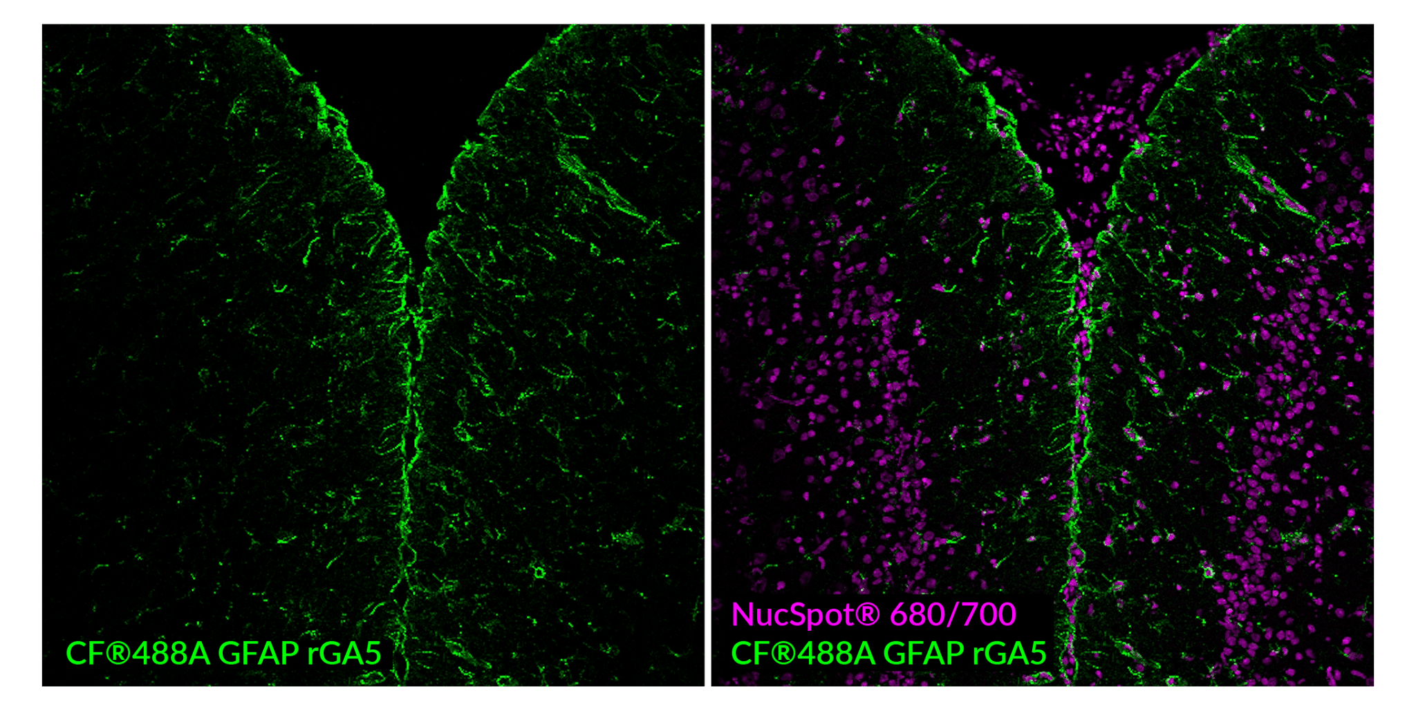 GFAP Recombinant Monoclonal Mouse Antibody (rGA5) - Biotium Choice ...