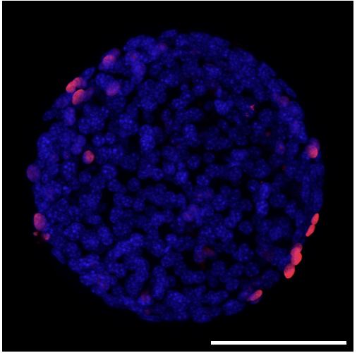 Stains for Spheroids, Organoids, & Other 3D Cultures - Biotium
