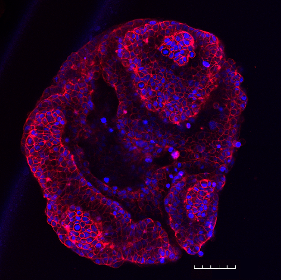 Stains for Spheroids, Organoids, & Other 3D Cultures - Biotium